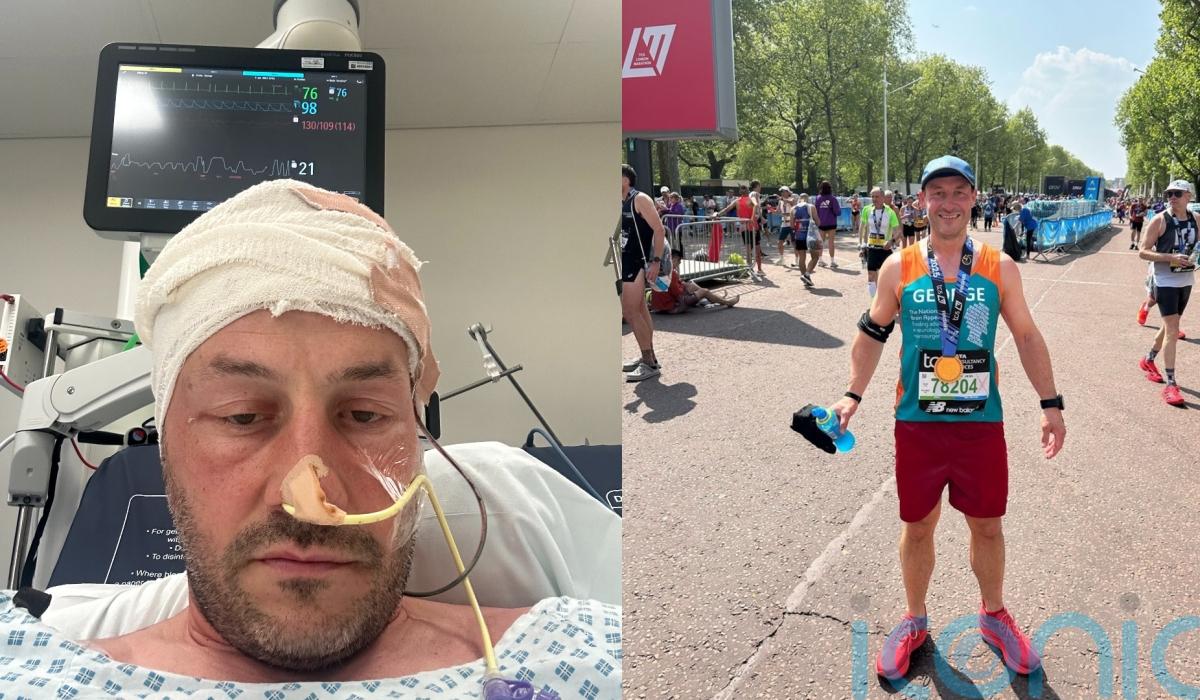 Runner who thought he would ‘surely’ die after double brain tumour news ...