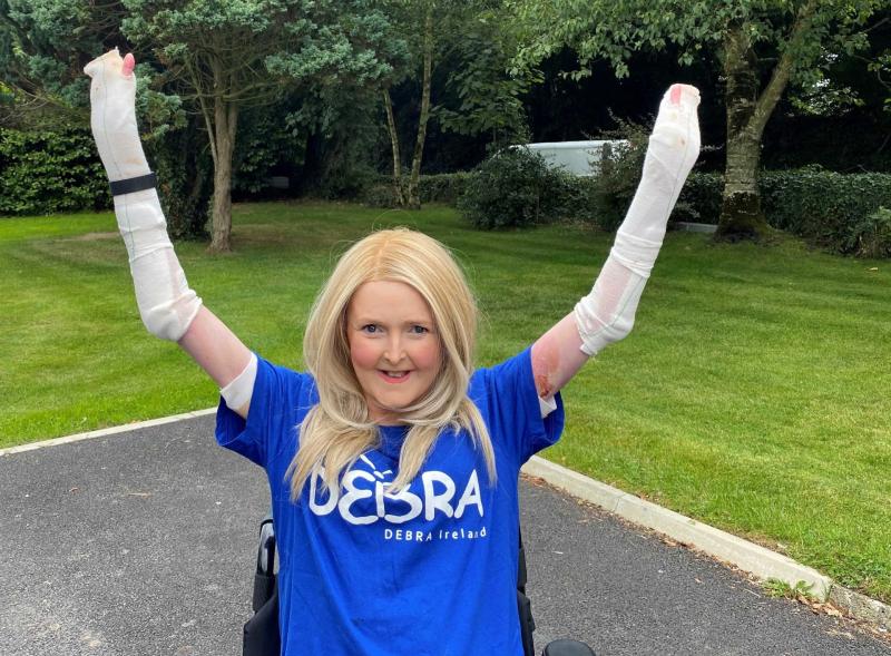 Laois hero Emma launches StepTember fundraiser for Debra Ireland ...